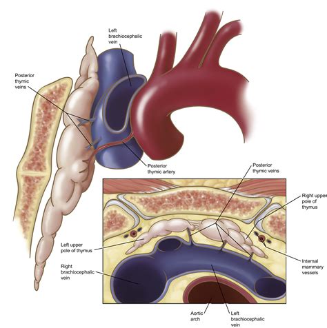 Anatomy Of The Thymus Gland Thoracic Surgery Clinics Images And