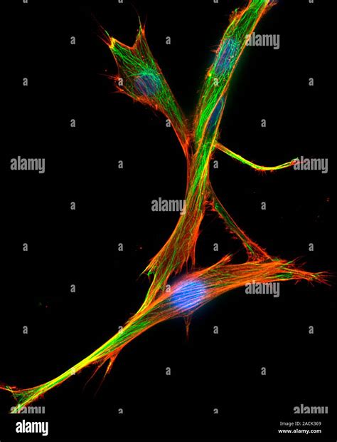 Fibroblast Cells Immunofluorescence Light Micrograph Of Fibroblast