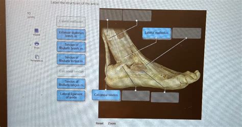 Solved 21 Correctly Label The Following Anatomical Parts Of Chegg