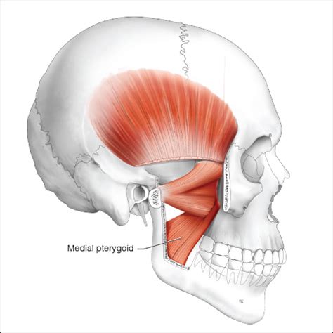 Medial Pterygoid Muscle