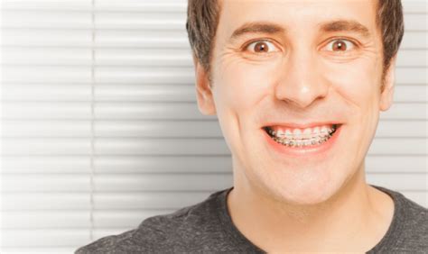 Maintaining Your Oral Health With Ceramic Braces Tips And Tricks