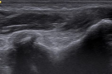 Audit Essay In MSK Ultrasound Sports Medicine Ultrasound Group