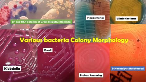 Various Bacteria Colonies Morphology Demo Proteus Pseudomonas