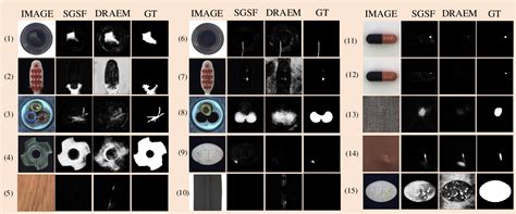 figure 1 from self supervised guided segmentation framework for unsupervised anomaly detection
