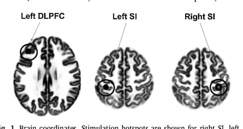 figure 1 from dorsolateral prefrontal cortex bridges bilateral primary somatosensory cortices