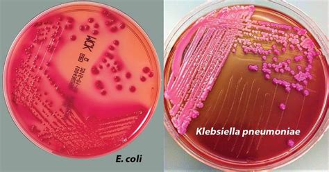 MacConkey Agar Was The First Solid Differential Media To Be Formulated