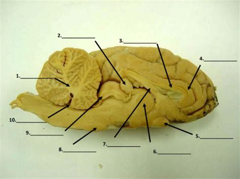 Sheep Brain Midsagittal Section Flashcards Quizlet