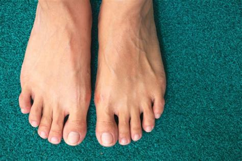 Dedos De Los Pies Telegraph