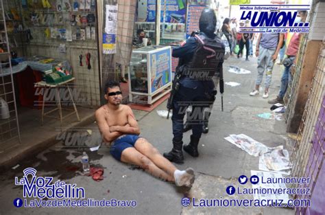 Dejan Semidesnudo Y Golpeado A Presunto Delincuente Medios