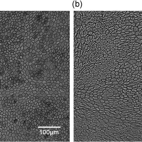 Epithelial Morphology In Differentiated Human Retinal Pigment