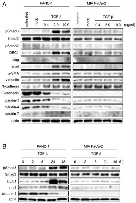 DEC1 expression is upregulated by TGF β in human pancreatic cancer