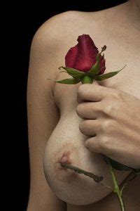 EXCLU Cancer du sein Tout n est pas rose dans le dépistage Dis