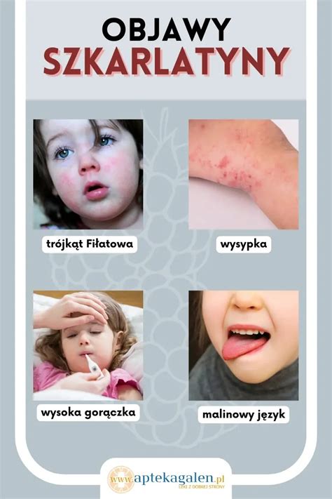 Szkarlatyna P Onica U Dzieci I Doros Ych Objawy I Leczenie Powik Ania