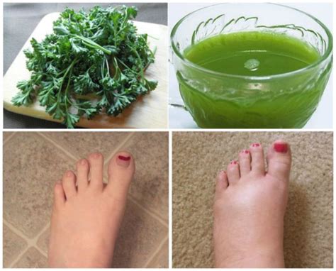 Este Es El Mejor Remedio Para Aliviar La Hinchaz N De Los Pies