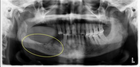 Dental Radiology Midterm Flashcards Quizlet