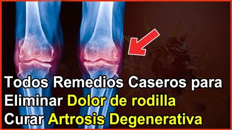 Elimina Dolor De Rodilla Y Cura La Artrosis Degenerativa De Inmediato