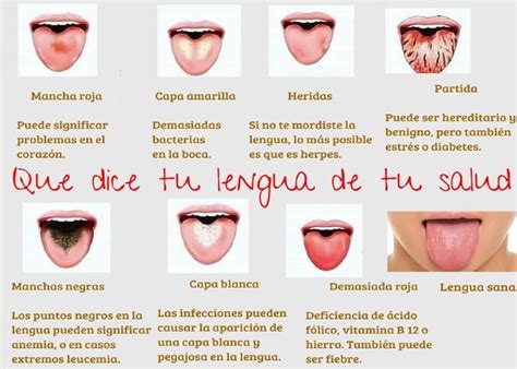 El Color De Tu Lengua Revela Tu Estado De Salud