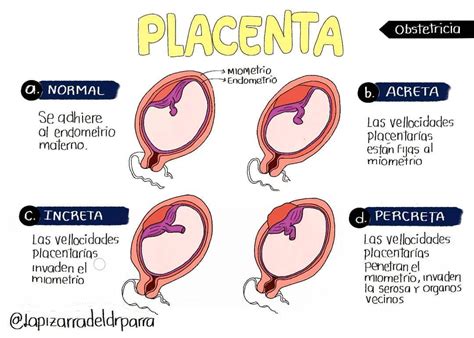 IMPLANTACIÓN DE LA PLACENTA enfermero enfermería