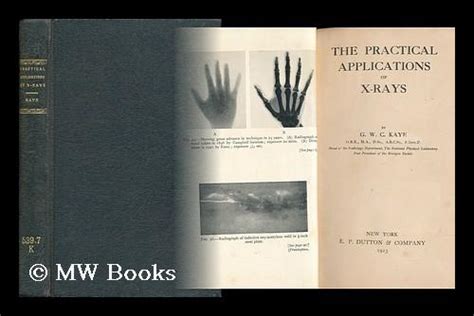 The Practical Applications Of X Rays By G W C Kaye Par Kaye G W