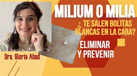Milium O Milian Te Salen Bolitas Blancas En La Cara C Mo Eliminar Y