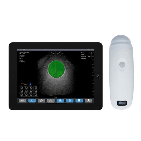 Hand Held Bladder Scanner BS2 Beijing ITrason Technologies