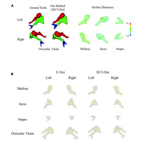 a a three dimensional display of the segmentation results on the download scientific diagram
