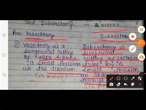 Difference Between Vasectomy Tubectomy Disadvantages Biology Class