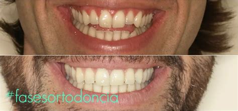 Proceso De Ortodoncia