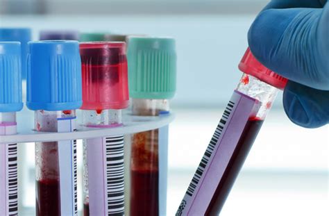 5 Mitos e Verdades sobre exames laboratoriais Blog Laboratório