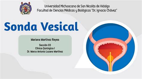 Sonda Vesical Mariana Martinez Reyes UDocz