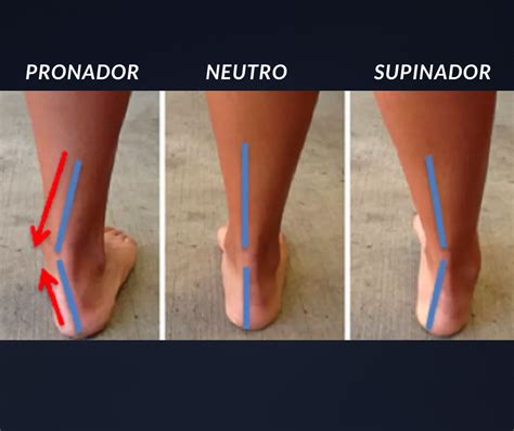 Pronador Neutro Supinador Guarda Runners