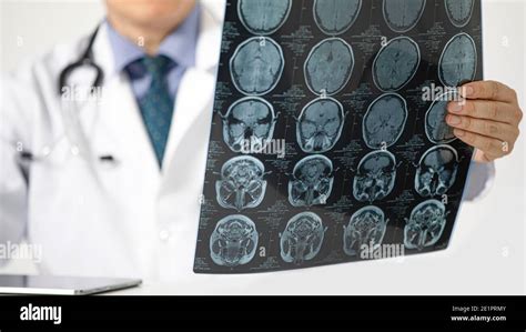 Irm Normal Du Cerveau Banque De Photographies Et Dimages Haute