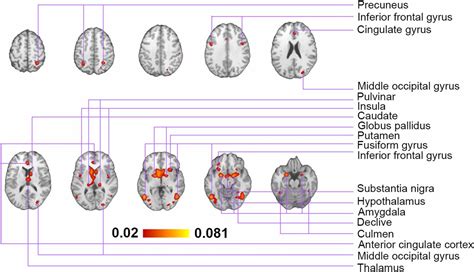 neural substrates of sexual arousal are not sex dependent pnas