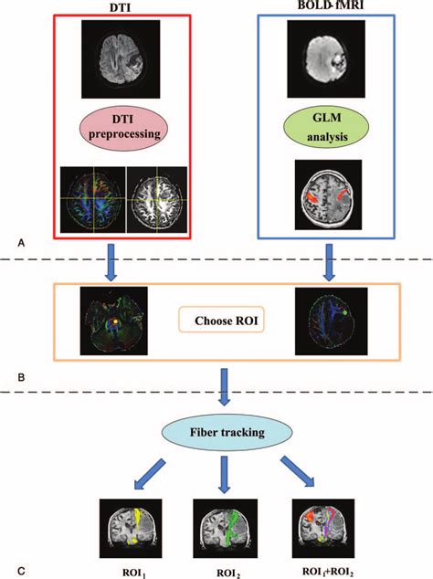a flow chart of the data processing steps a dti and task based fmri download scientific