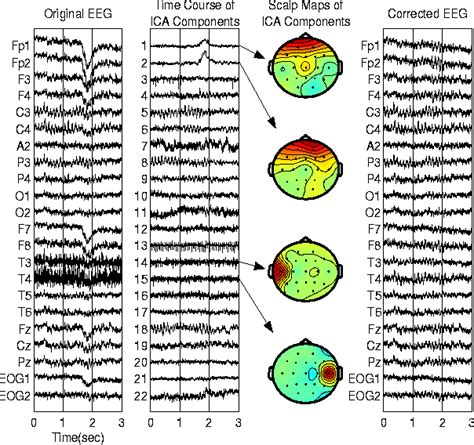 eeg artifact removal with blind source separation