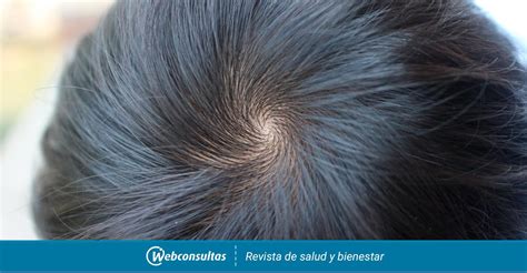 Remolinos en el pelo por qué aparecen y cómo peinarlos