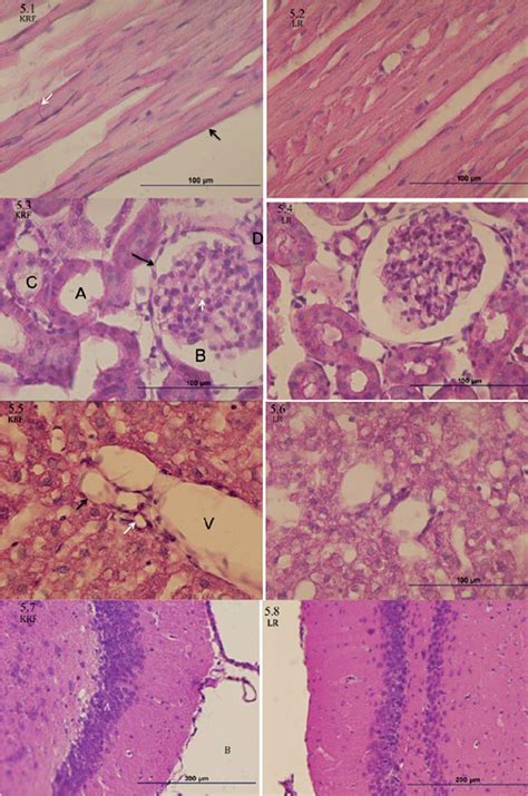 Tissue Histology Cardiac Muscle Histology Endocardial Simple