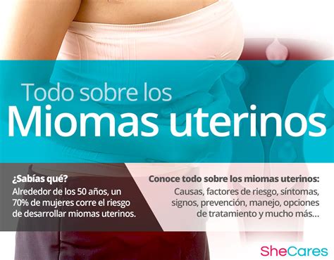 Miomas Uterinos Shecares