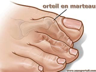Orteil définition et explications