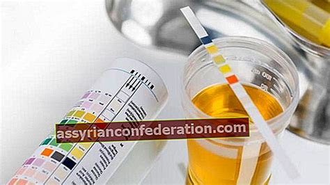Cosa Dice Il Colore Delle Tue Urine