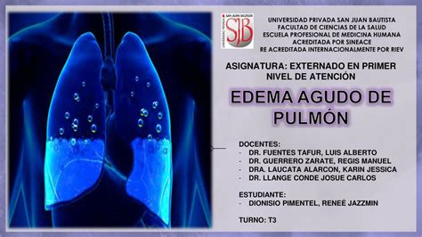 Edema Agudo de Pulmón Reneé Jazzmin uDocz