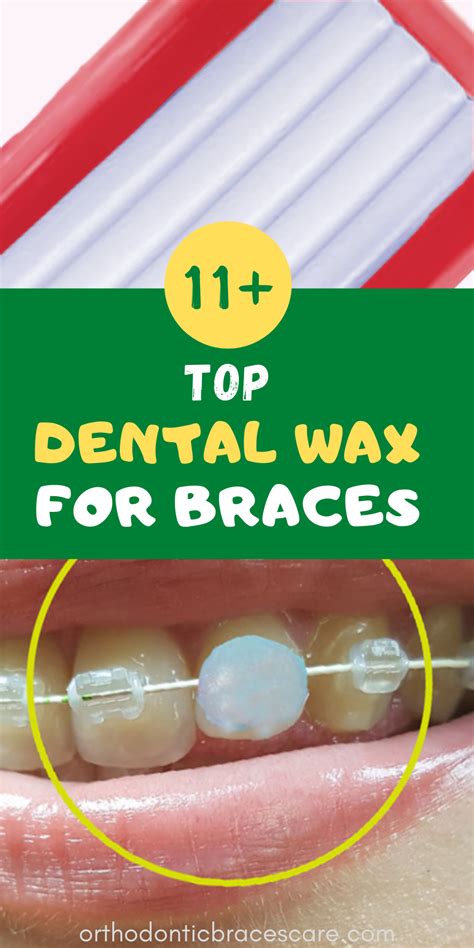 Best Dental Wax For Braces 5 Flavored And 7 Unflavored Artofit