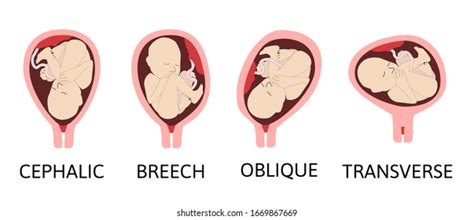 5 382 Baby Uterus Background Royalty Free Images Stock Photos