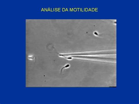 PROTENAS DO PLASMA SEMINAL MARCADORES BIOQUMICOS DE FERTILIDADE