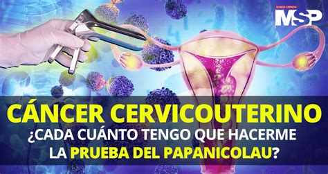 Qué es la Prueba de Papanicolaou y por qué es vital para prevenir