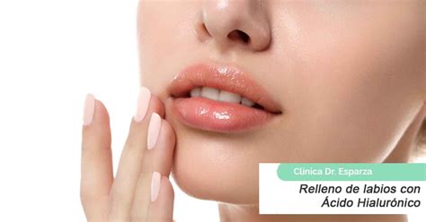 Modelado de labios con Ácido Hialurónico y sus beneficios Dr Esparza