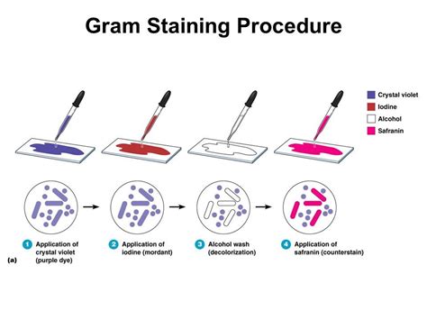 Gram Staining Well Explained UPDATED Laboratory Insider Medical