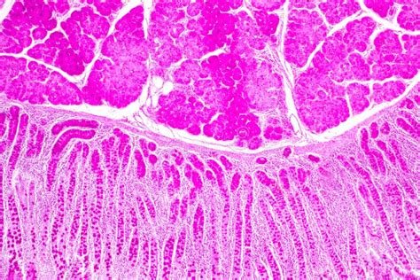 Small Intestine Duodenum And Vermiform Appendix Human Under The