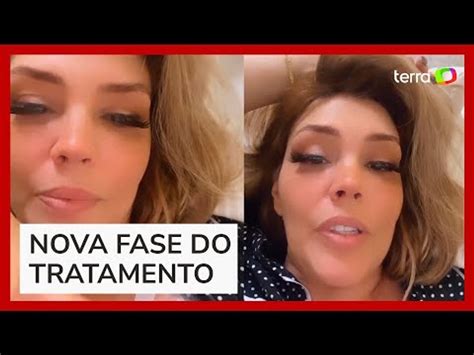 Internada cantora Simony dá detalhes sobre nova etapa de tratamento