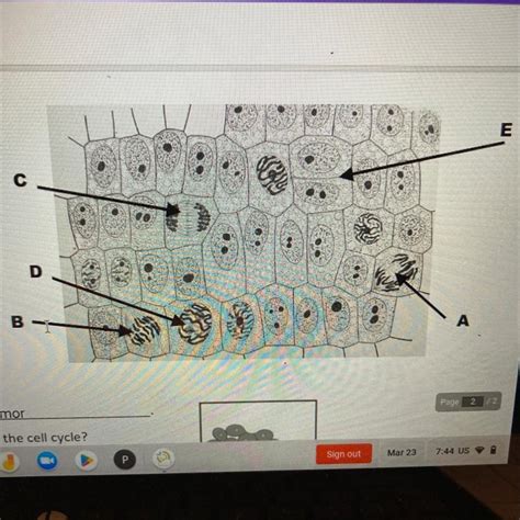 Identify The Stage Of Mitosis Each Lettered Plant Cell Is In Brainly